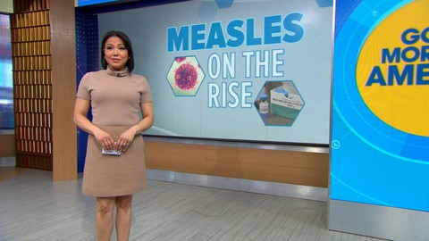Measles cases on the rise in US | Haystack News